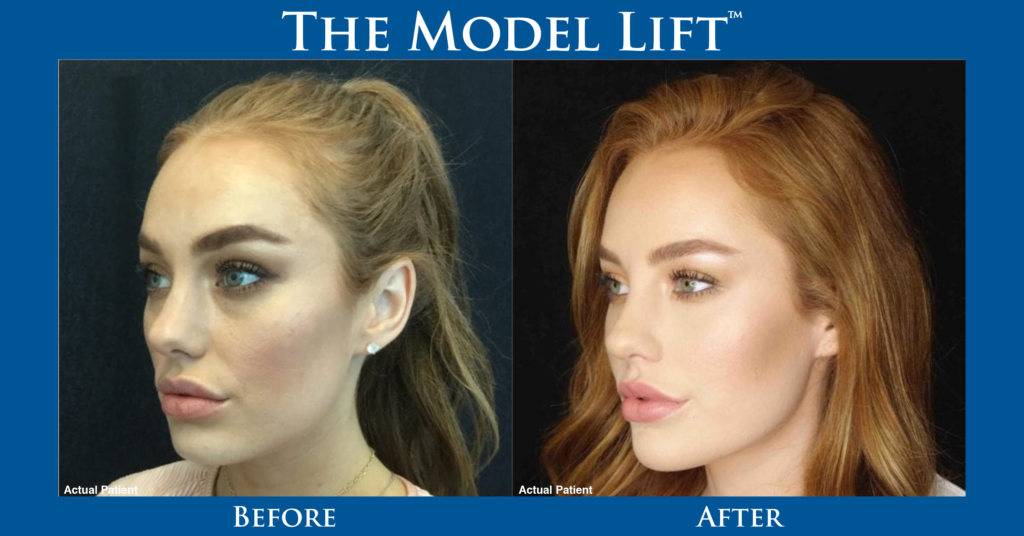 The Model Lift - Your Health Magazine